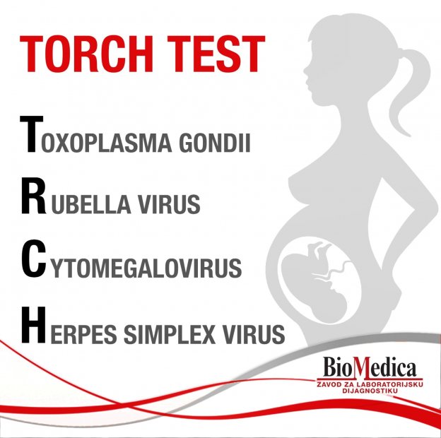 TORCH TEST Za Trudnice BioMedica TORCH TEST Za Trudnice BioMedica